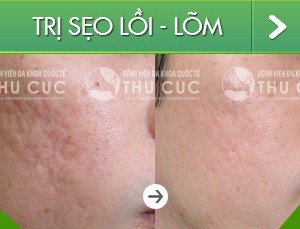 Thu Cúc Sài Gòn - Thẩm mỹ uy tín tại Sài Gòn